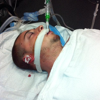 Help For Aaron Harding After Being Hit By A Car | Indiegogo