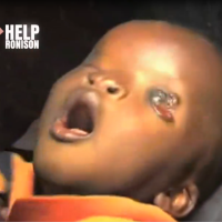 The boy with no eyelids | Indiegogo