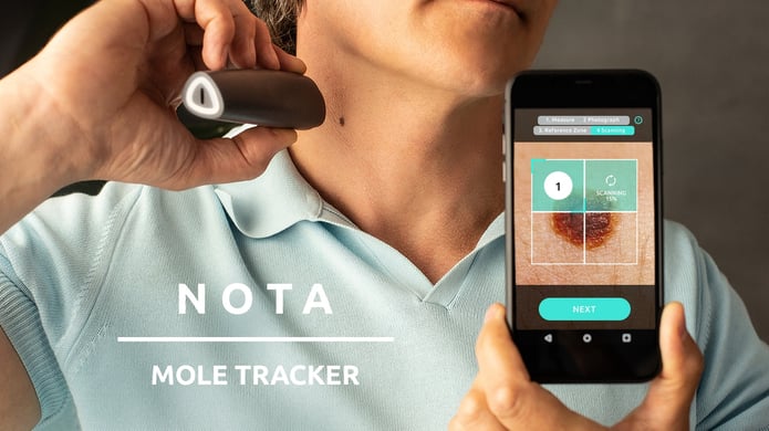NOTA Mole Tracker Take Charge of Your Skin At Home | Indiegogo
