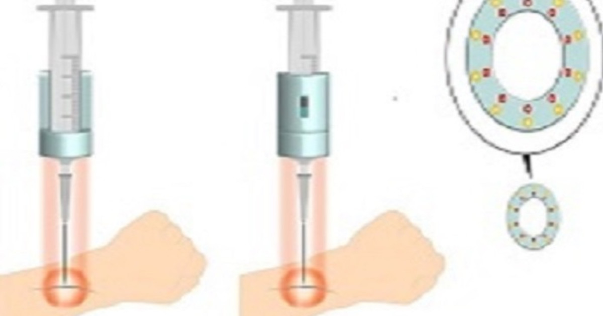 Syringe Vein Finder | Indiegogo