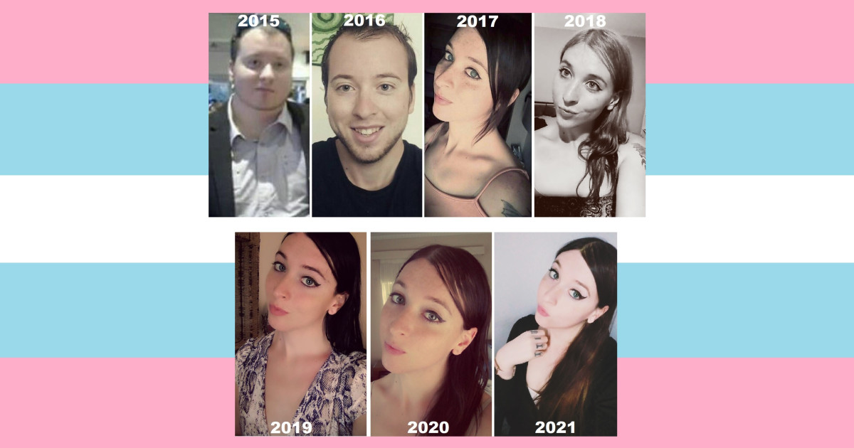 Help Ash Pay For GCS Surgery | Indiegogo