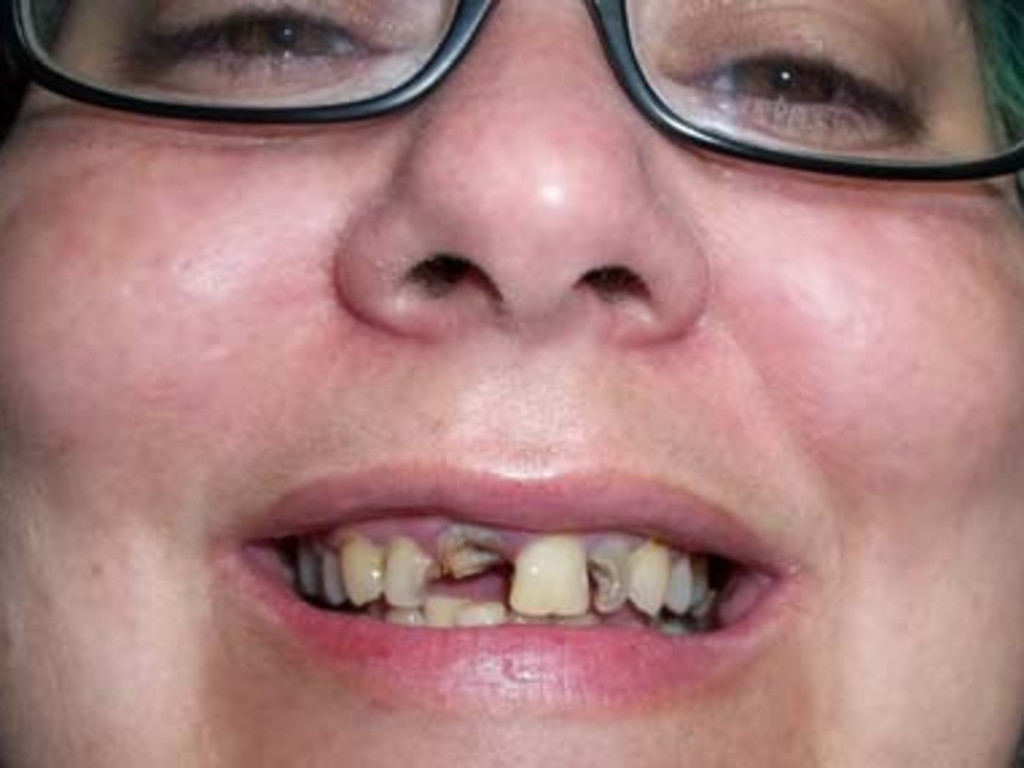 Buy Willow some Teeth! | Indiegogo