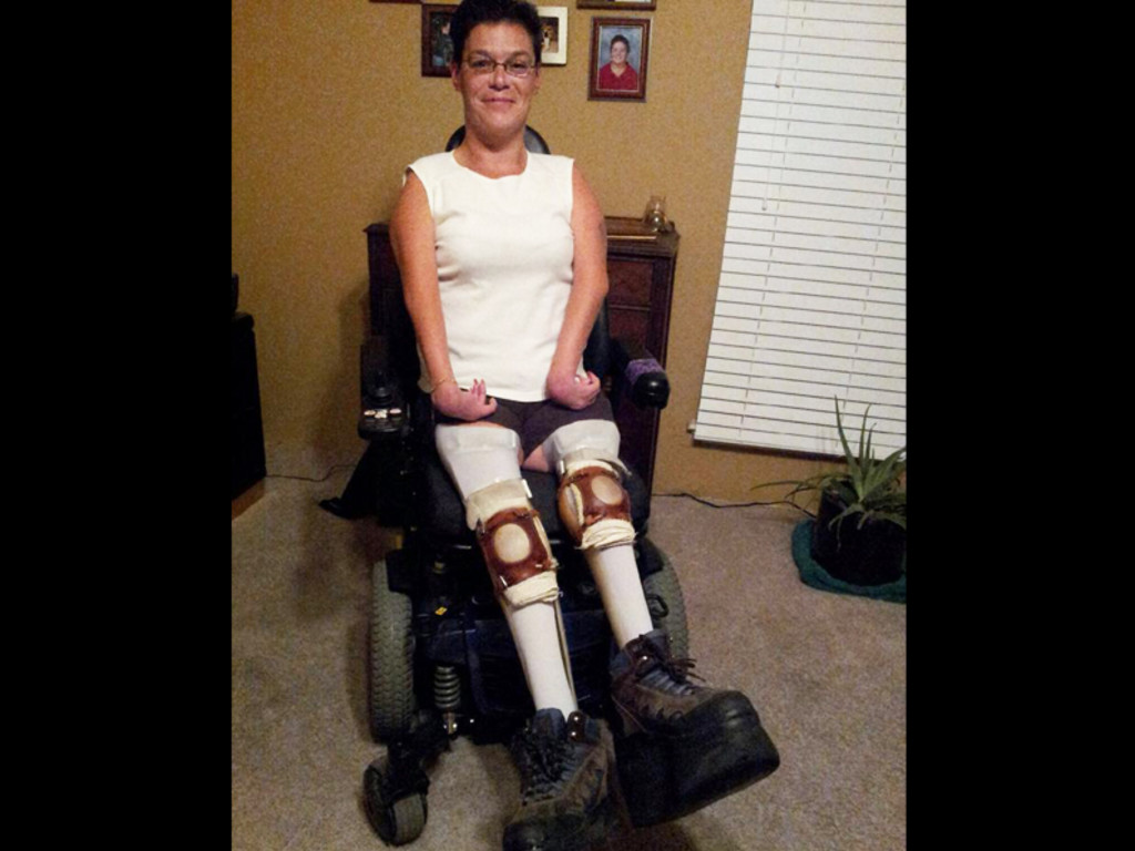 Amanda Needs New Leg Braces | Indiegogo Amanda Needs New Leg Braces | Indiegogo