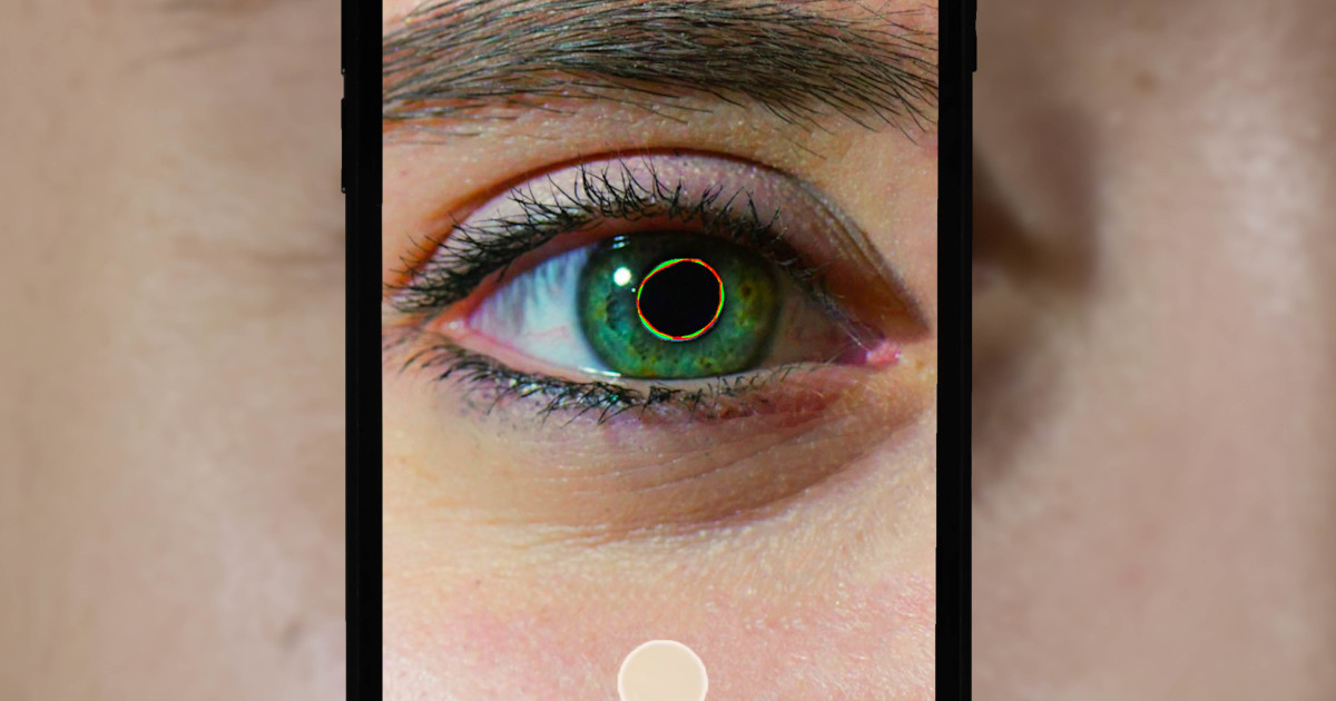 How To Check Eyes For Concussion With Flashlight PostureInfoHub