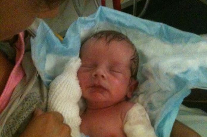 Help Save Easton- baby battling Epidermolysis Bullosa- EB | Indiegogo