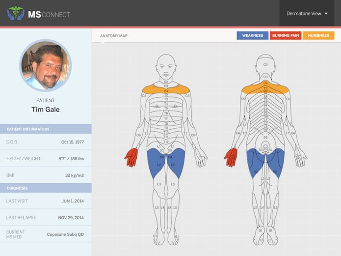 MS Connect- A Better Future for Multiple Sclerosis | Indiegogo