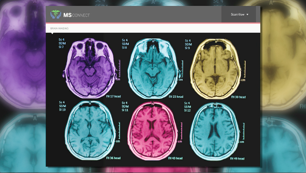 MS Connect- A Better Future for Multiple Sclerosis | Indiegogo