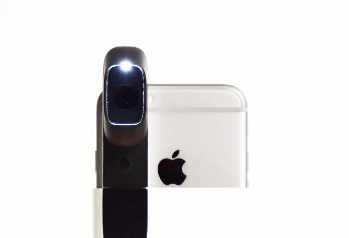 HUD: Screen for Skin Cancer on your Smartphone | Indiegogo