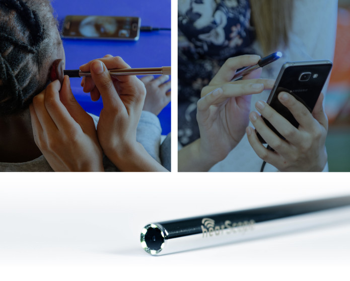 hearScope : Next generation smartphone otoscope | Indiegogo