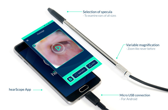 hearScope : Next generation smartphone otoscope | Indiegogo
