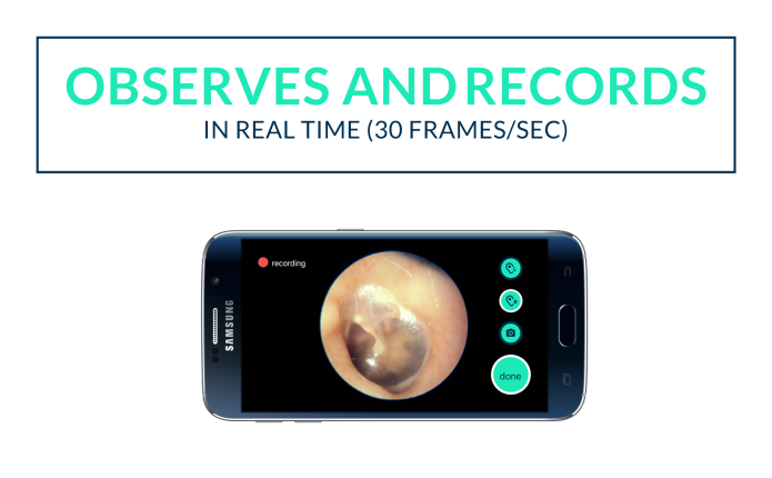 hearScope : Next generation smartphone otoscope | Indiegogo