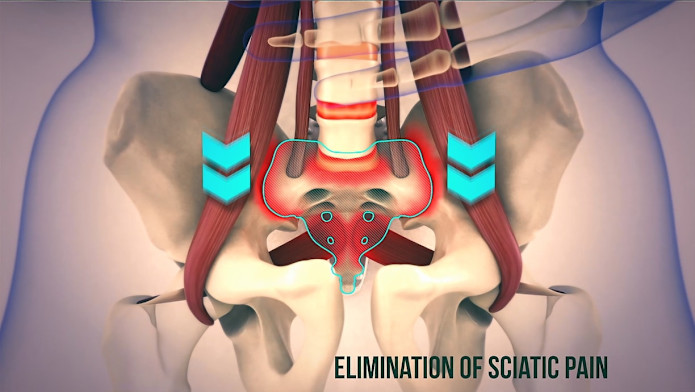 Sacrus - Healing Your Spine | Indiegogo