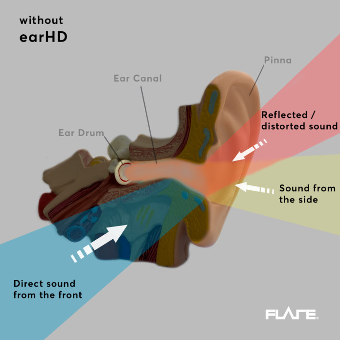 earHD - Upgrade your ears - by Flare Audio | Indiegogo