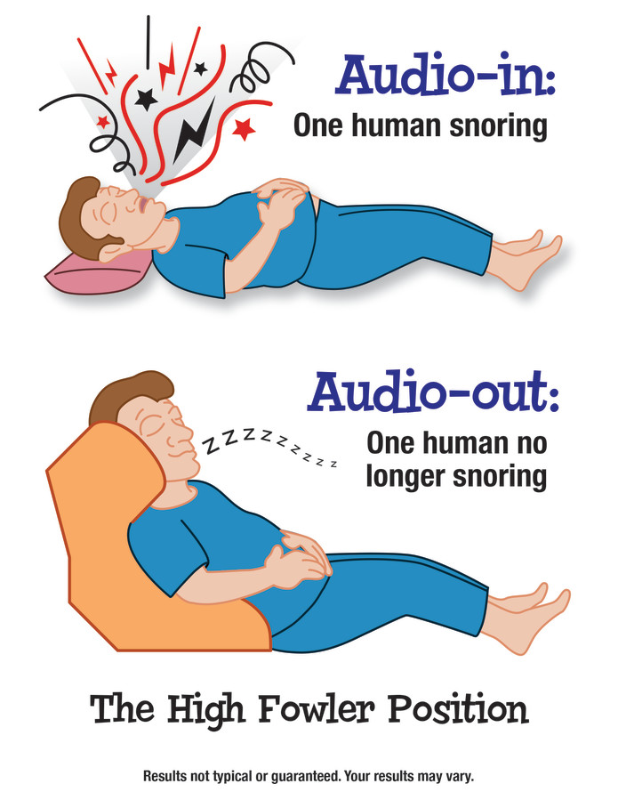 The Snorinator: I Stopped Snoring With Just This! | Indiegogo