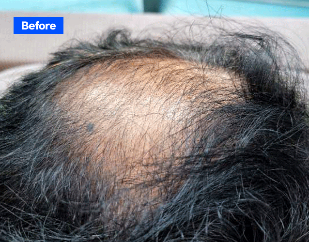 Dr. Root: Smart Hair and Scalp Care Solution | Indiegogo