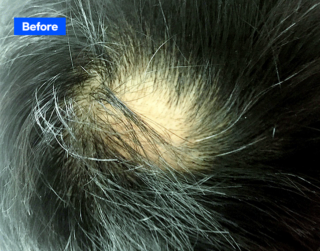 Dr. Root: Smart Hair and Scalp Care Solution | Indiegogo