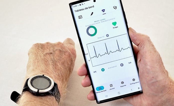 DTECTIO Wearable ECG Monitor - AI-Empowered | Indiegogo
